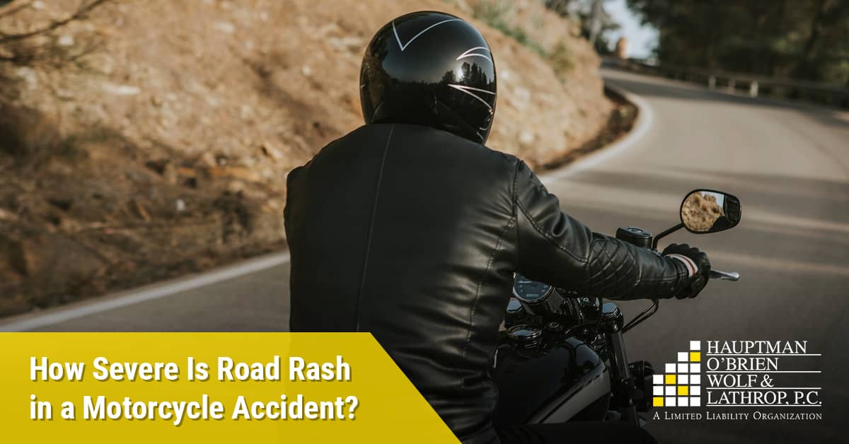 Is Road Rash from a Motorcycle Accident Serious?