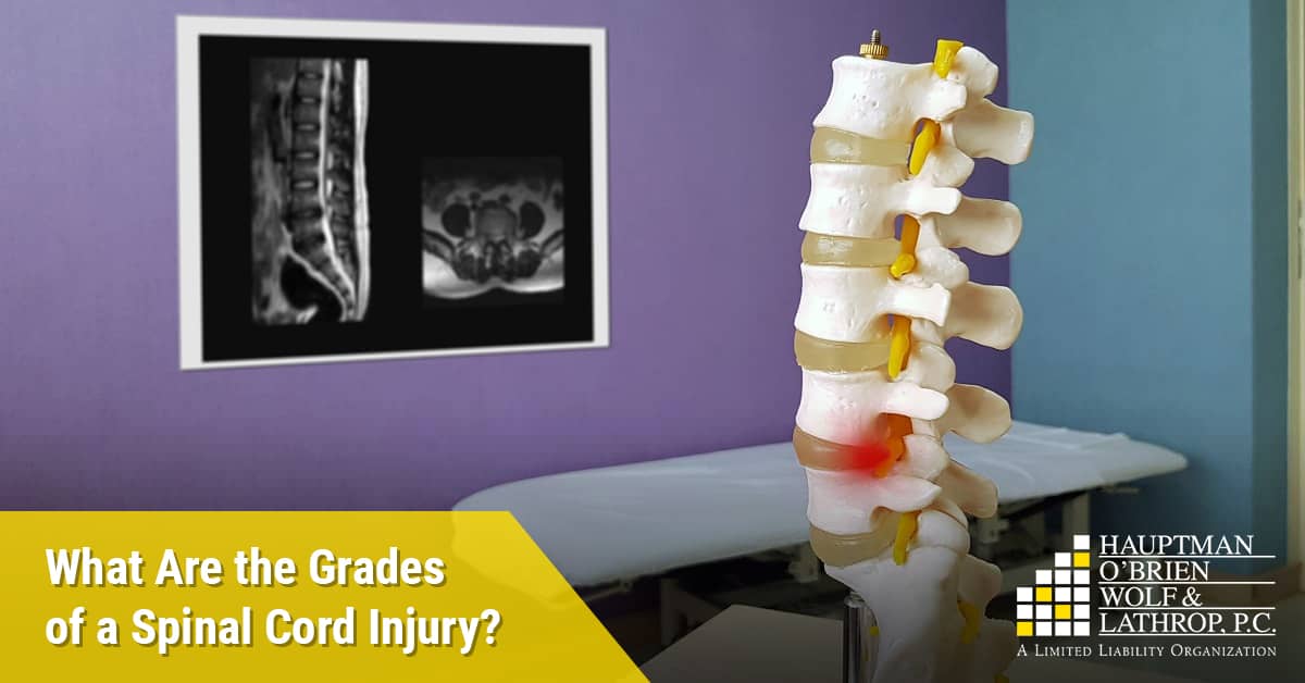 How Serious Is a Spinal Cord Injury? | Omaha, Nebraska